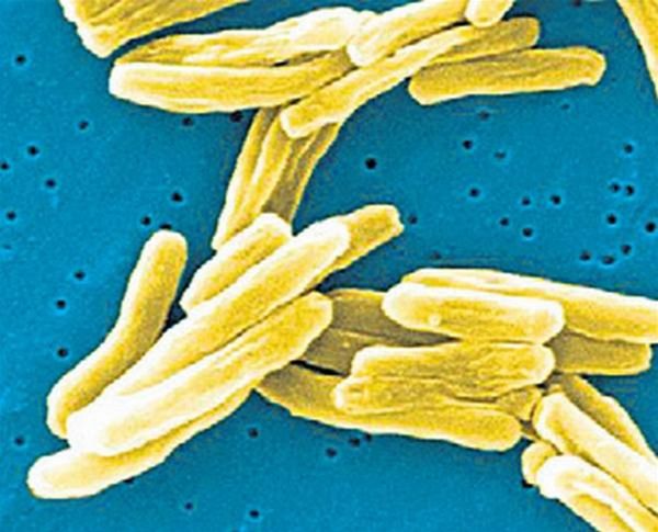 Od pacienta s tuberkulózou sa nakazili zdravotné sestry - Regióny ...
