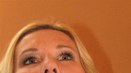 Schudnutá Barkolová: Kvôli kráse sa vrhla na botox! Čo poviete ...