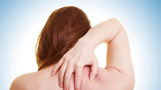 Atopický ekzém: Koža ako strúhadlo - Zdravie a prevencia - Zdravie - Pravda