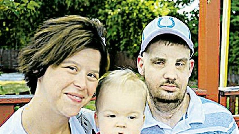 BBC: Efekt Pomahačovej transplantácie tváre je ohromujúci - Svet ...